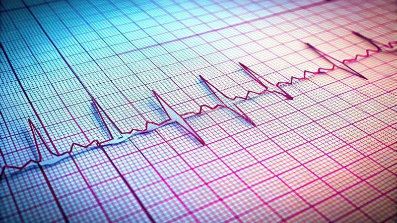 Cardiac Rhythm Strip Stock Illustrations – 17 Cardiac Rhythm Strip ...