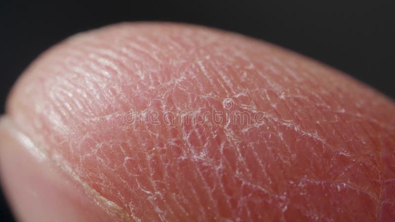 White Detailed Caucasian Human Skin on Hand Fingers Closeup in Macro ...
