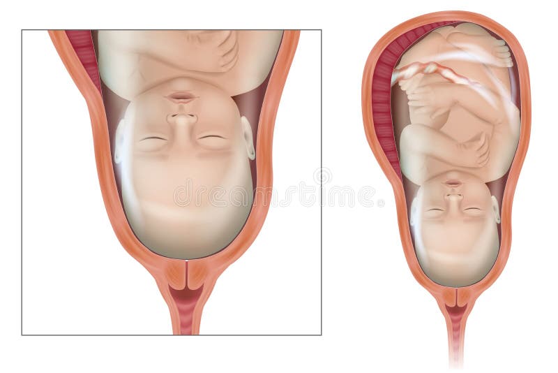 Fetus Womb Diagram Stock Illustrations – 155 Fetus Womb Diagram Stock ... Fetus Womb Diagram Stock Illustrations – 155 Fetus Womb Diagram Stock ...