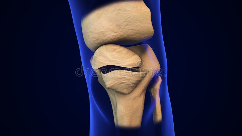 Broken Patella Bone Medical Concept Stock Illustration - Illustration ...