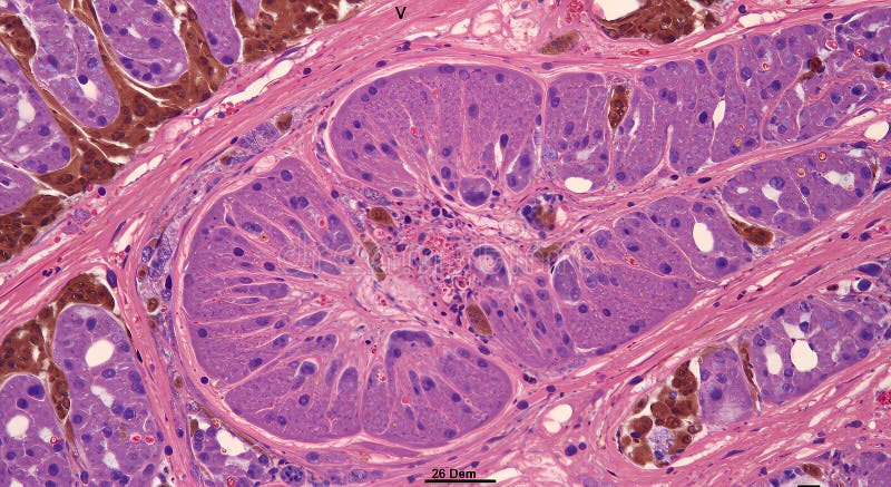 Detailed Microscopic View of Tissue Sample Showing Cellular Structures ...