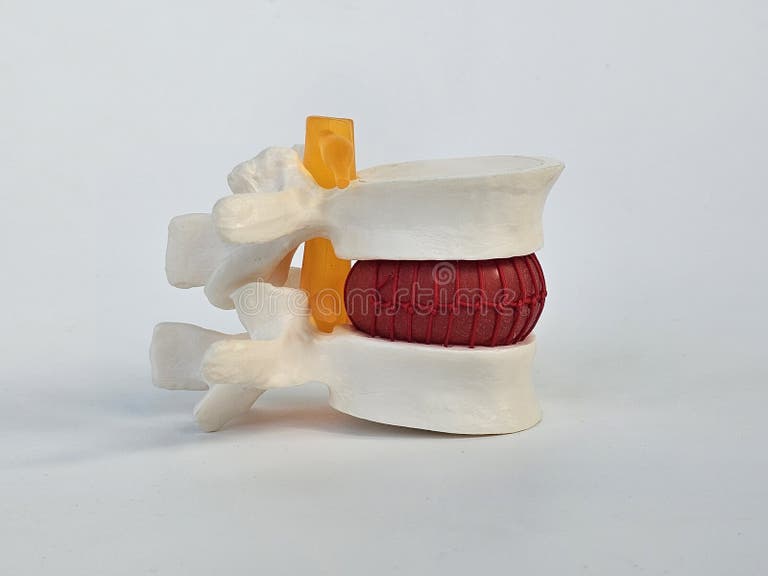 Detailed Model of a Human Spinal Segment Showcasing Vertebrae and ...