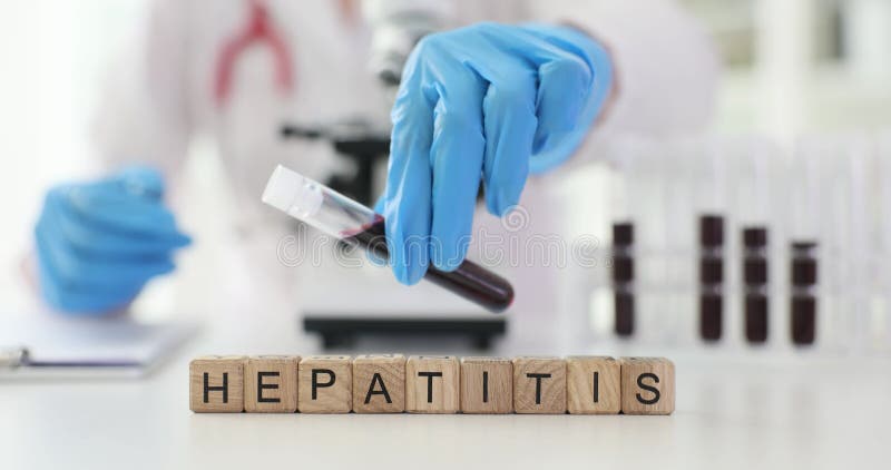 Detailed Study of Hepatitis is Carried Out in Laboratory Specialists ...