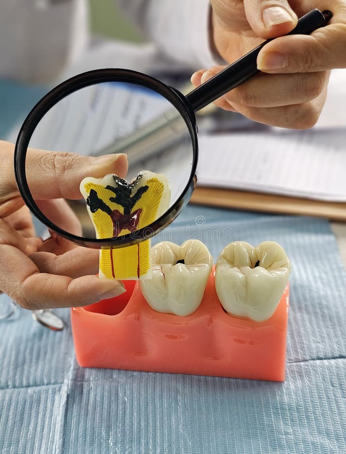 Detailed Study of a Tooth Model Using a Magnifying Glass at a Dental ...