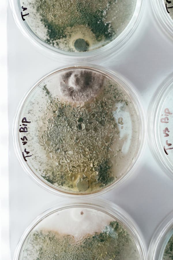 Detailed Top View. Trichoderma and Sclerotinia in the Laboratory in the ...