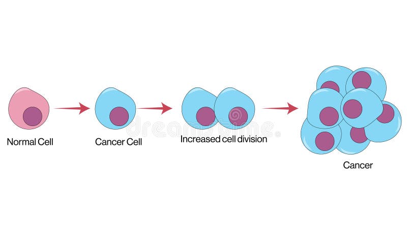 Vector Illustration of Normal Cell To Cancer Cell Formation, Metastasis ...