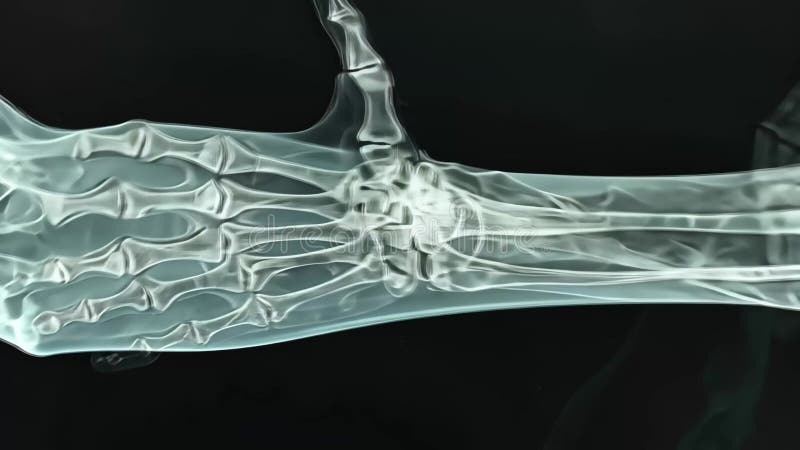 A Detailed View of a Human Arm X-ray Reveals the Complex Structure of ...