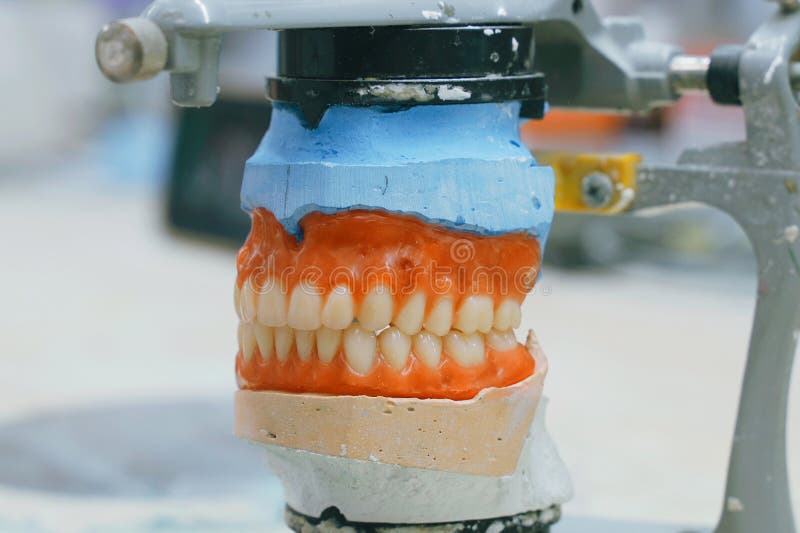 Close-Up of Tooth Model on Table Stock Photo - Image of medicine ...