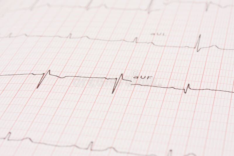 ECG, Detalle Del Electrocardiograma, Concepto Sano Etc Del Corazón Con ...