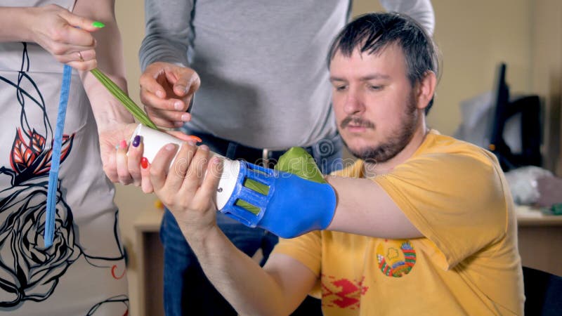 Determinación Del Miembro Artificial En La Mano Amputada Almacen De ...