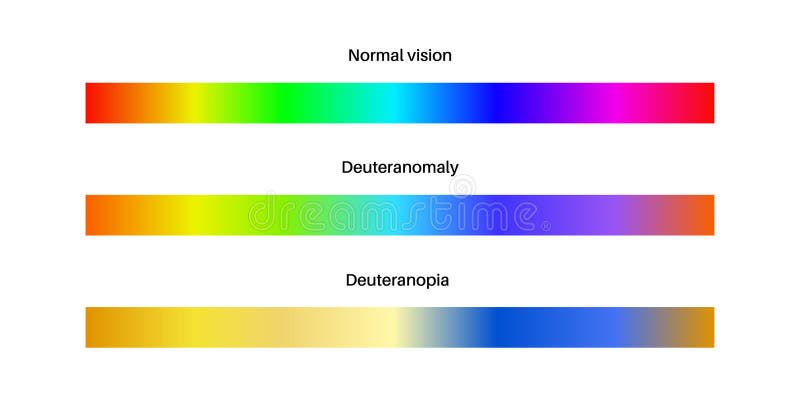 Deuteranomaly Deuteranopia Stock Illustrations – 56 Deuteranomaly ...