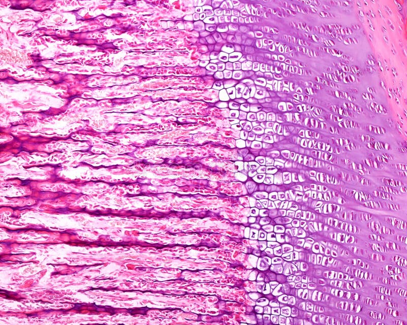 Developing Bone Epiphyseal Growth Plate Stock Image Image Of Cell Micrograph 273097785
