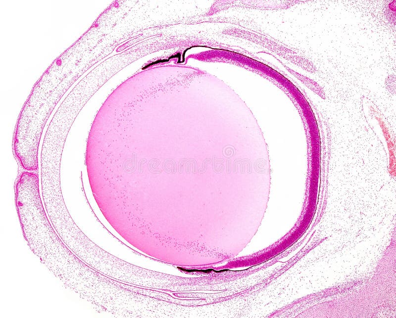 Developing Retina. Optic Nerve Stock Image - Image of optic, anatomy ...