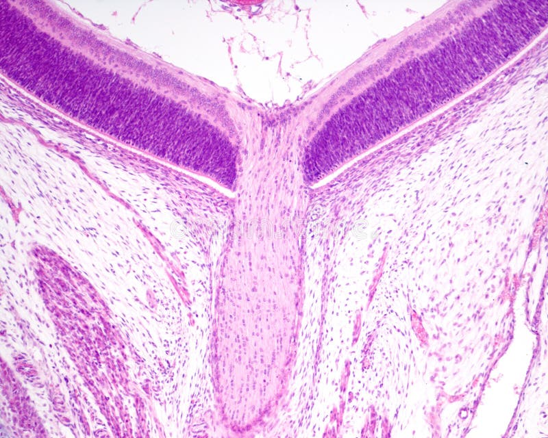Developing Retina. Optic Nerve Stock Image - Image of optic, anatomy ...