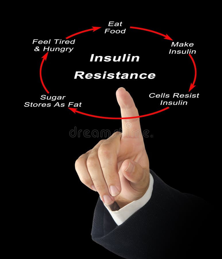 Development of Insulin Resistance Stock Image - Image of development ...