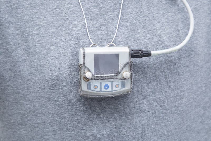 A Device for Measuring the Work of the Heart. Portable Device, for ...