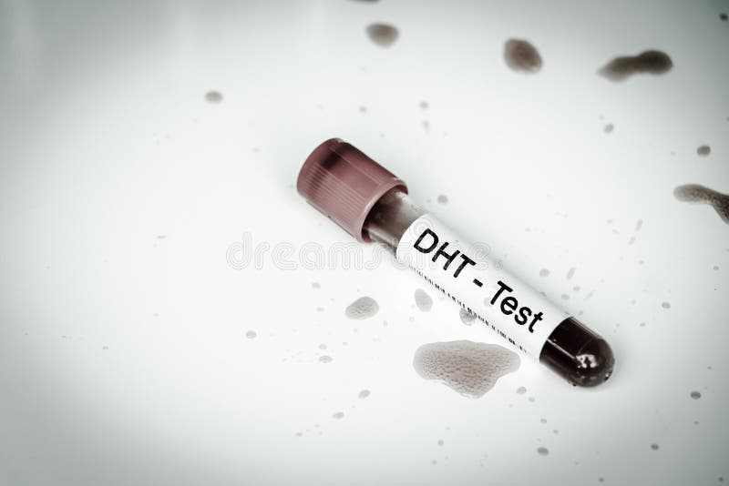 DHT Test To Look for Abnormalities from Blood Stock Image - Image of ...