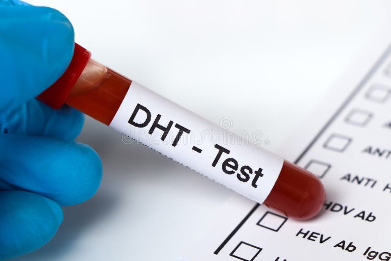 DHT Test To Look for Abnormalities from Blood Stock Image - Image of ...