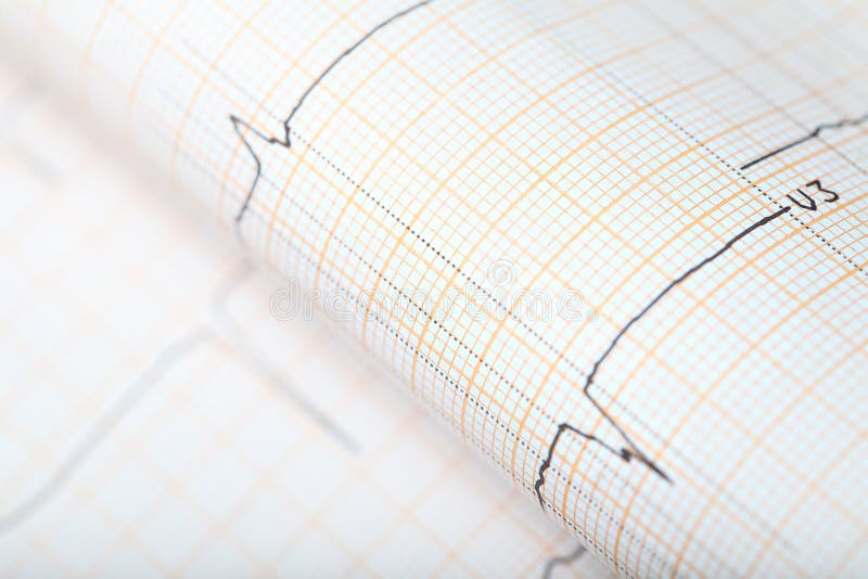 Diagnostic ECG Chart Concept Stock Image - Image of cardiologist ...