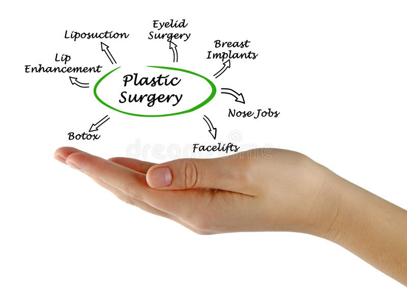 Diagram of Plastic Surgery stock image. Image of important - 85644925