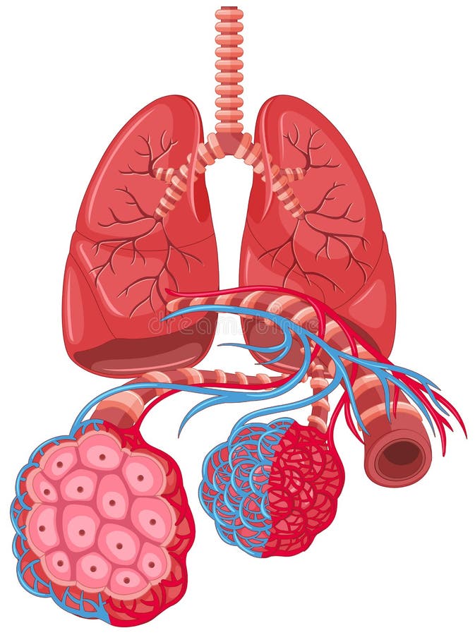 Diagram Showing Lung Cancer Stock Vector - Illustration of illness ...