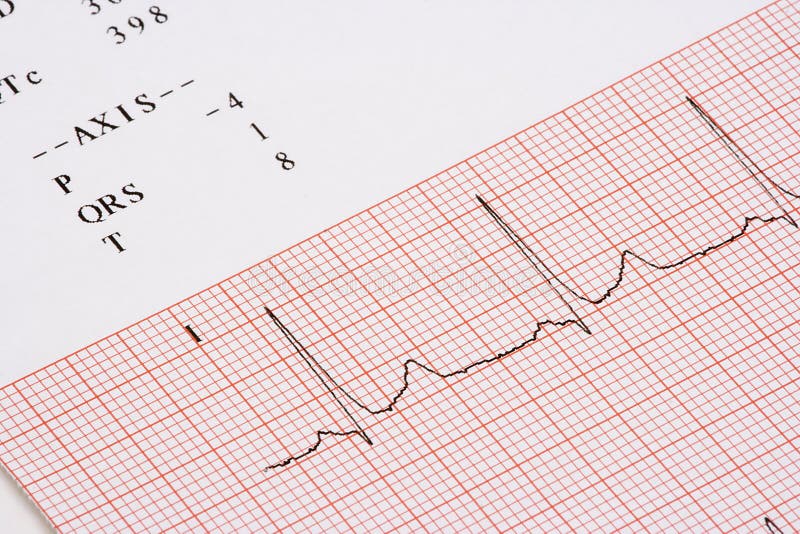 Nastro ECG Elettrocardiografo (con Tracciato Di Ritaglio) Fotografia ...