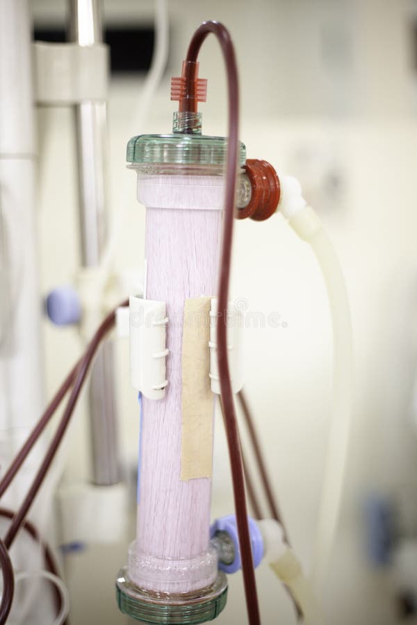 Dialysis Device in the Hospital Stock Photo - Image of channel, washing ...
