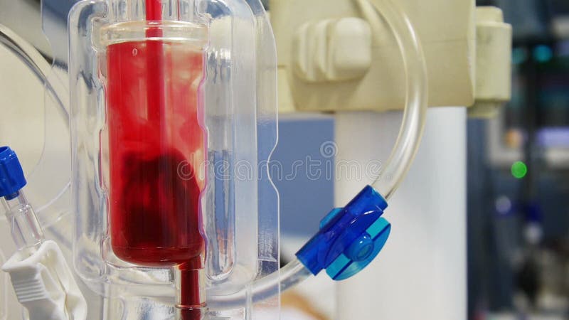 Dialysis Machine Blood Filling Stock Footage - Video of medical ...