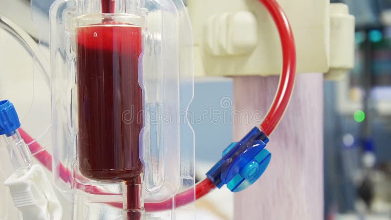 Dialysis Machine Blood Filling Stock Video - Video of purification ...