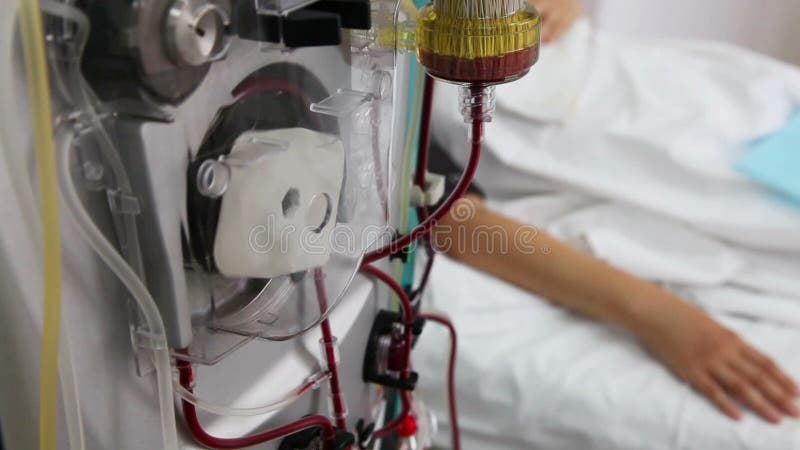 Dialysis Medical Device with Patient Stock Footage - Video of ...