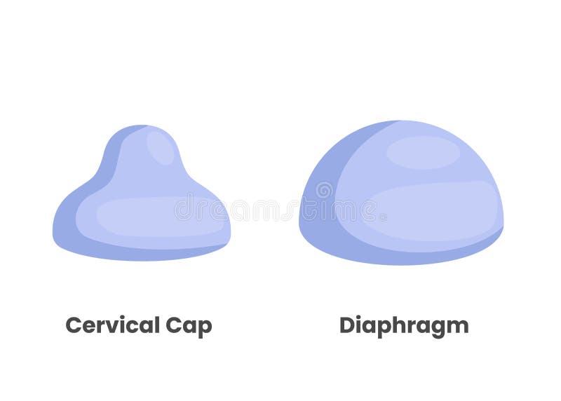 Diaphragm and cervical cap stock vector. Illustration of female - 146861362