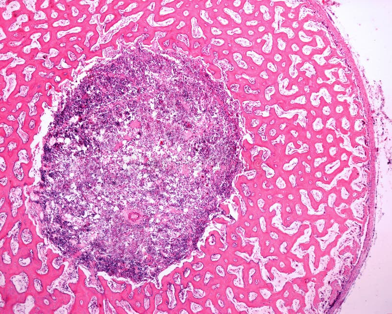 Diaphyse D'un Os Embryonnaire Image stock - Image du embryon ...