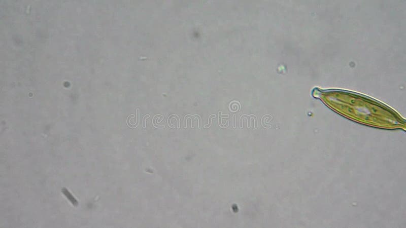 Diatoms Under Microscope 400x