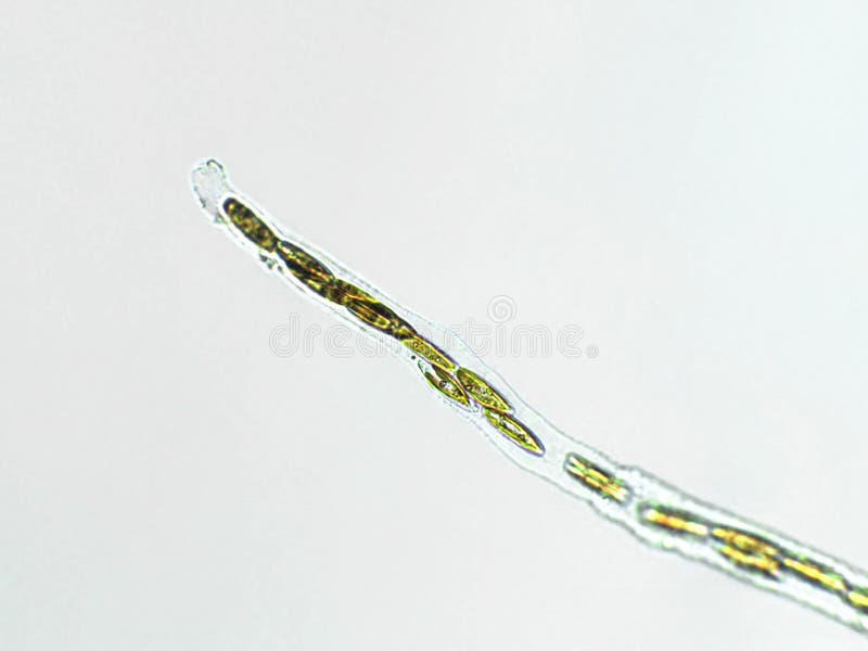 Diatom Algae Under Microscopic View, Phytoplankton, Fossils, Silica ...