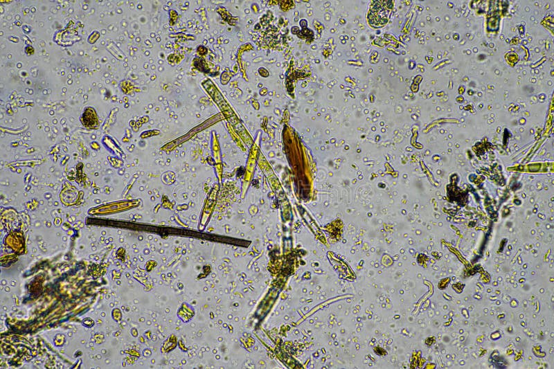 Diatoms Under Microscope 100x