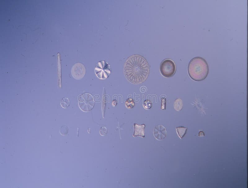 Diatomas Del Mar Bajo El Microscopio Foto de archivo - Imagen de ...