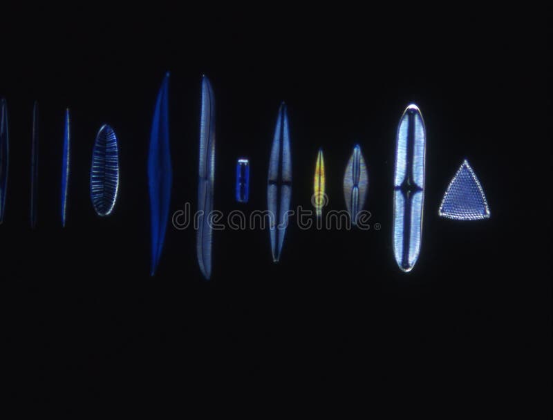 Diatomas Del Mar Bajo El Microscopio Foto de archivo - Imagen de negro ...
