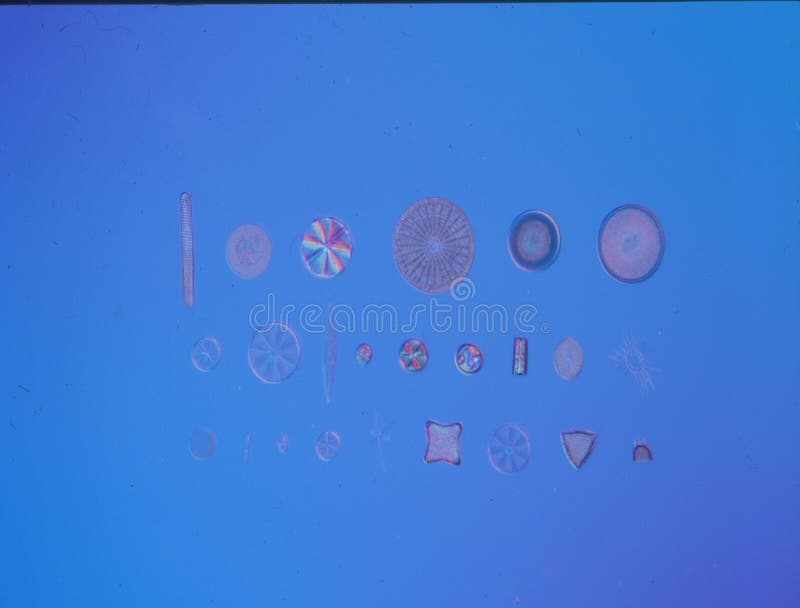 Diatomeas del mar foto de archivo. Imagen de negro, microscopio - 194437866