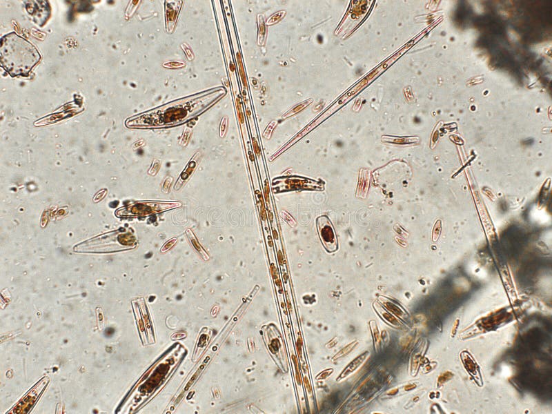 Diatomaceous Earth Under Microscope Photos - Free & Royalty-Free Stock ...