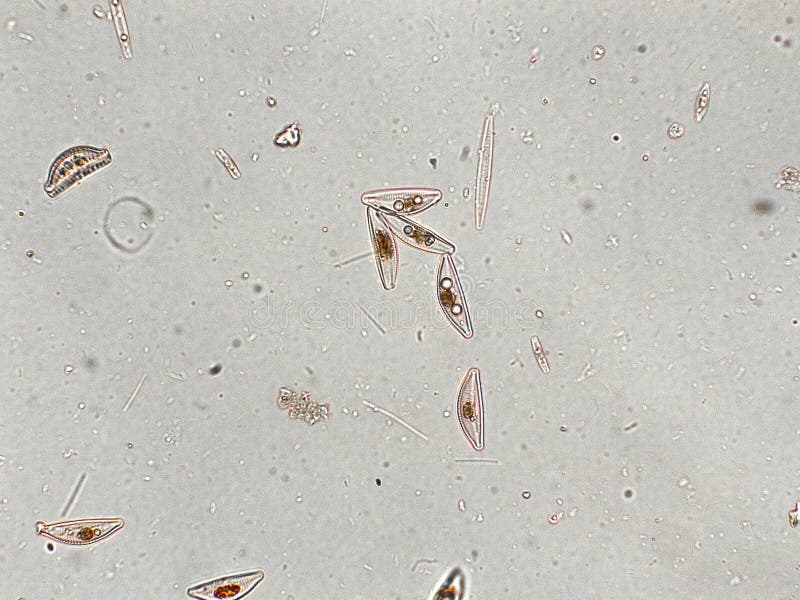 Diatoms Under Microscopic View Stock Photo - Image of environmental ...
