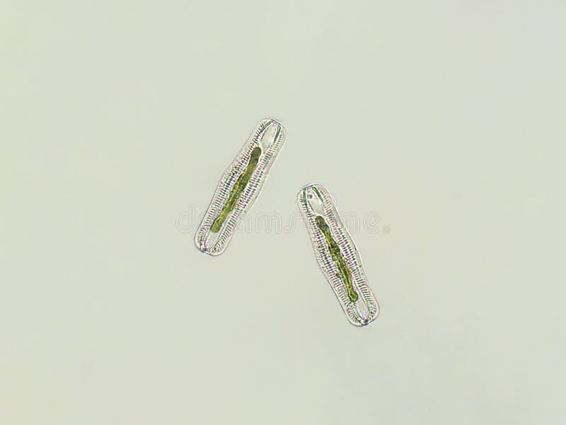 Diatoms Under Microscopic View Stock Photo - Image of microscopic ...