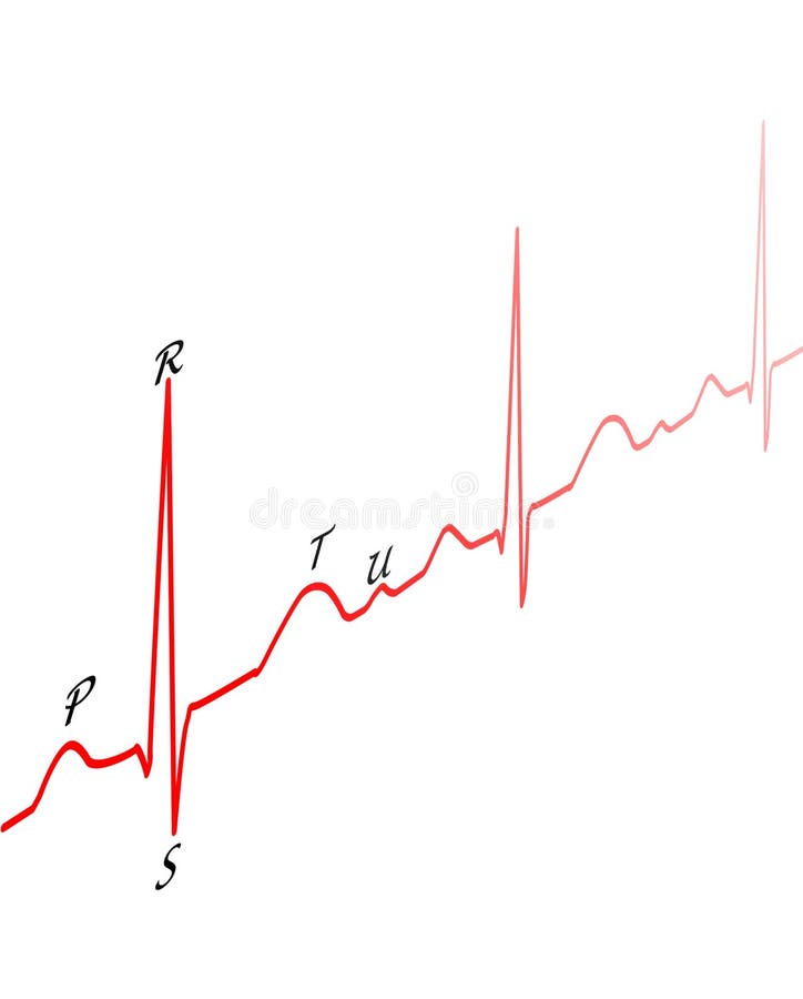 Dibujo ECG stock de ilustración. Ilustración de actividad - 94359556