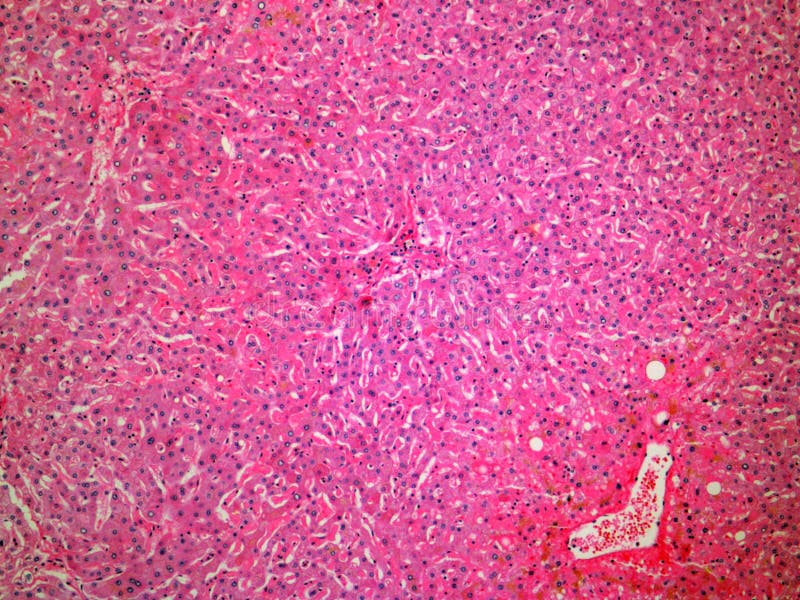 Die Leber, Wie Von Einem Histologist Gesehen Stockbild - Bild von organ ...