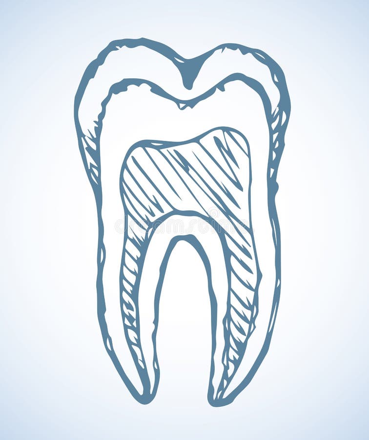 Diente Gráfico del vector ilustración del vector. Ilustración de carie ...