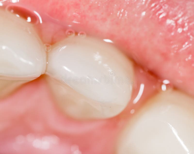 Dientes en la boca Macro foto de archivo. Imagen de boca - 107488960