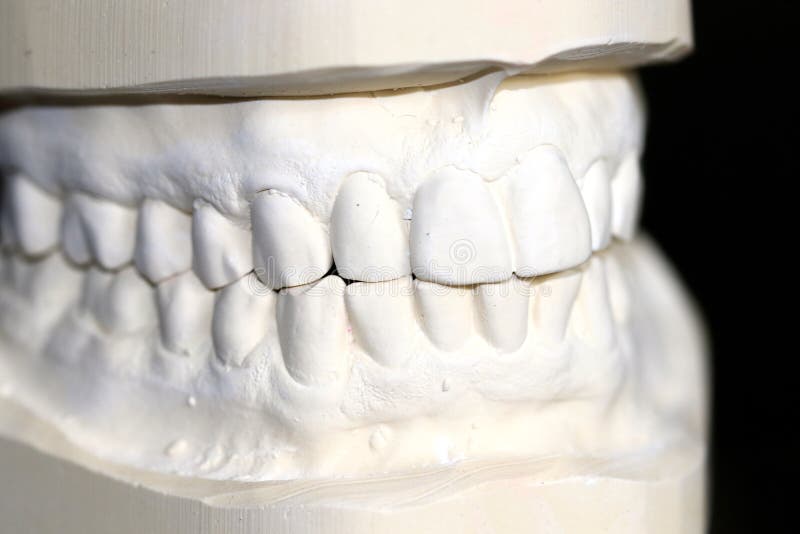 Dientes Humanos Hechos Del Yeso Foto de archivo - Imagen de molde ...