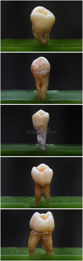 Dientes humanos naturales imagen de archivo. Imagen de dentista - 42515825