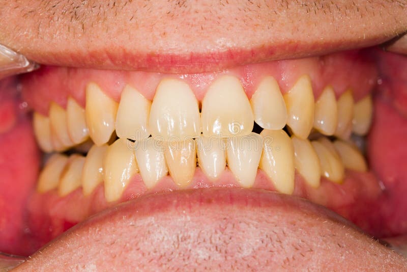 Imagenes De Boca Con Dientes Bonitos Fotos de stock - Fotos libres de ...