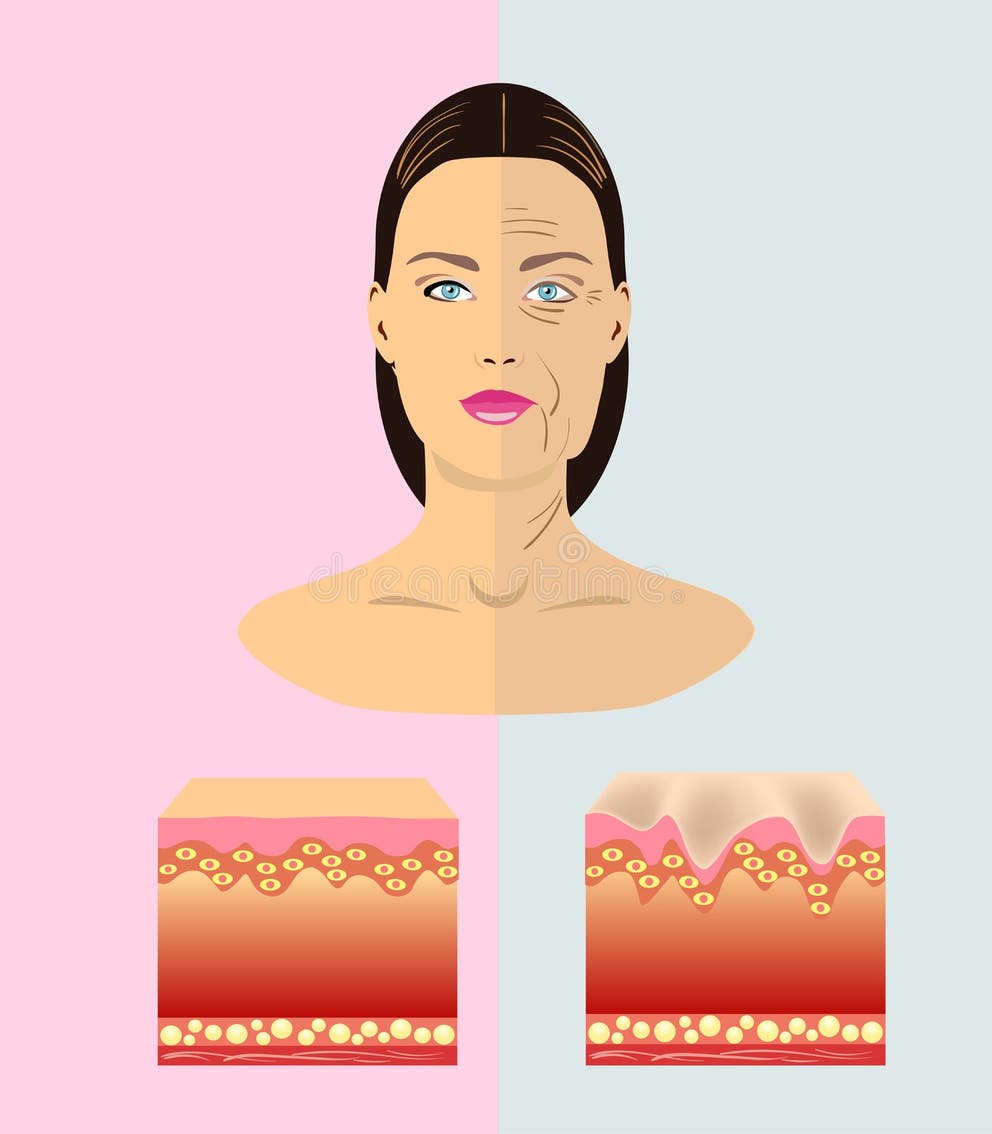 Difference Skin Stock Illustrations – 627 Difference Skin Stock Illustrations, Vectors & Clipart ...
