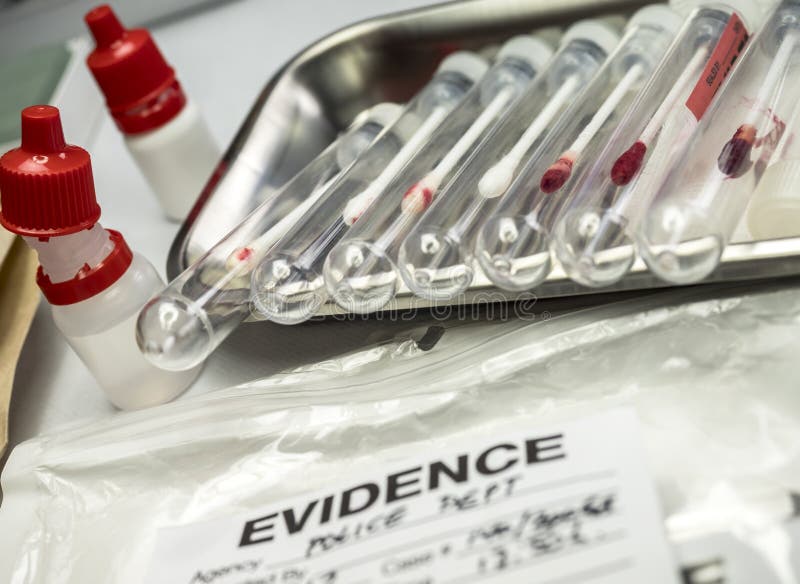 Different Samples Hair and Blood To Analyze in the Laboratory ...